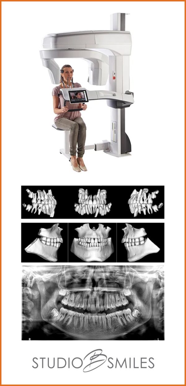 Learn More about Cone Beam CT - 3D Imaging